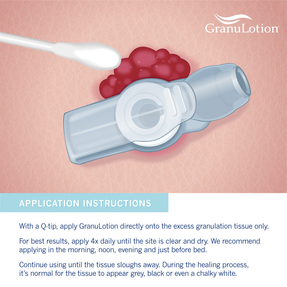 GranuLotion® 1/2 oz. Tube - Free US Shipping! – GranuLotion