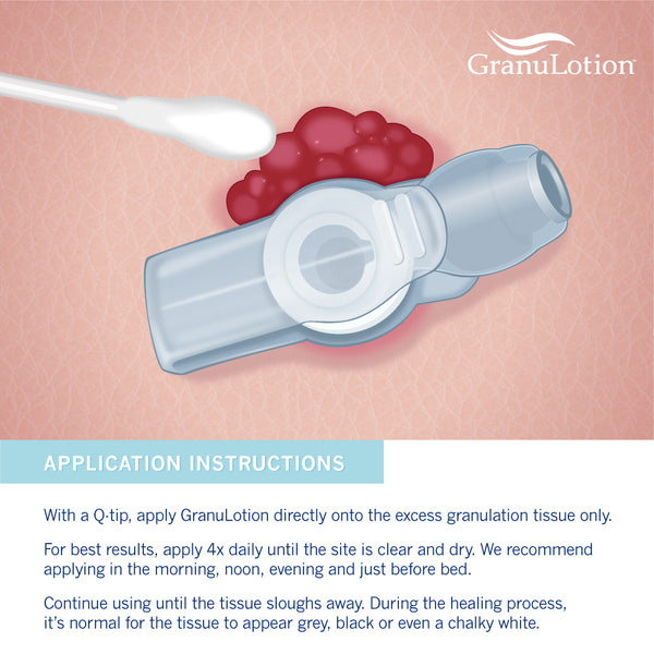 Treatment Packets - 2-Pack - Free US Shipping! – GranuLotion